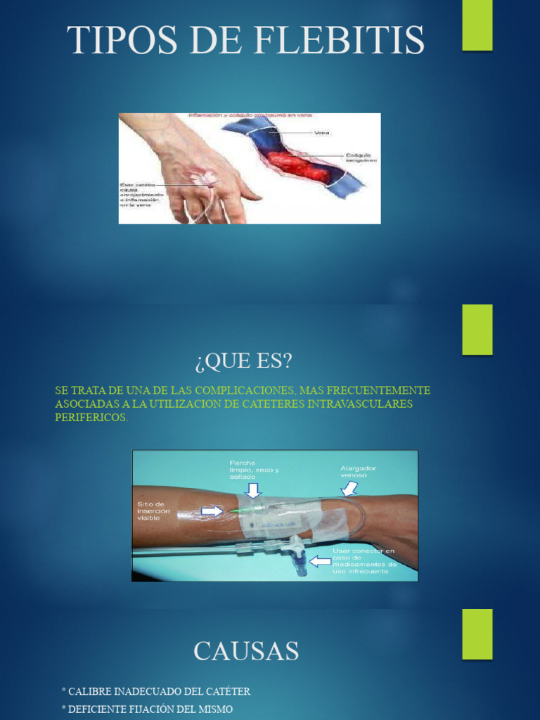 Tipos de Flebitis y 15 Correctos | PDF | Salud y bienestar