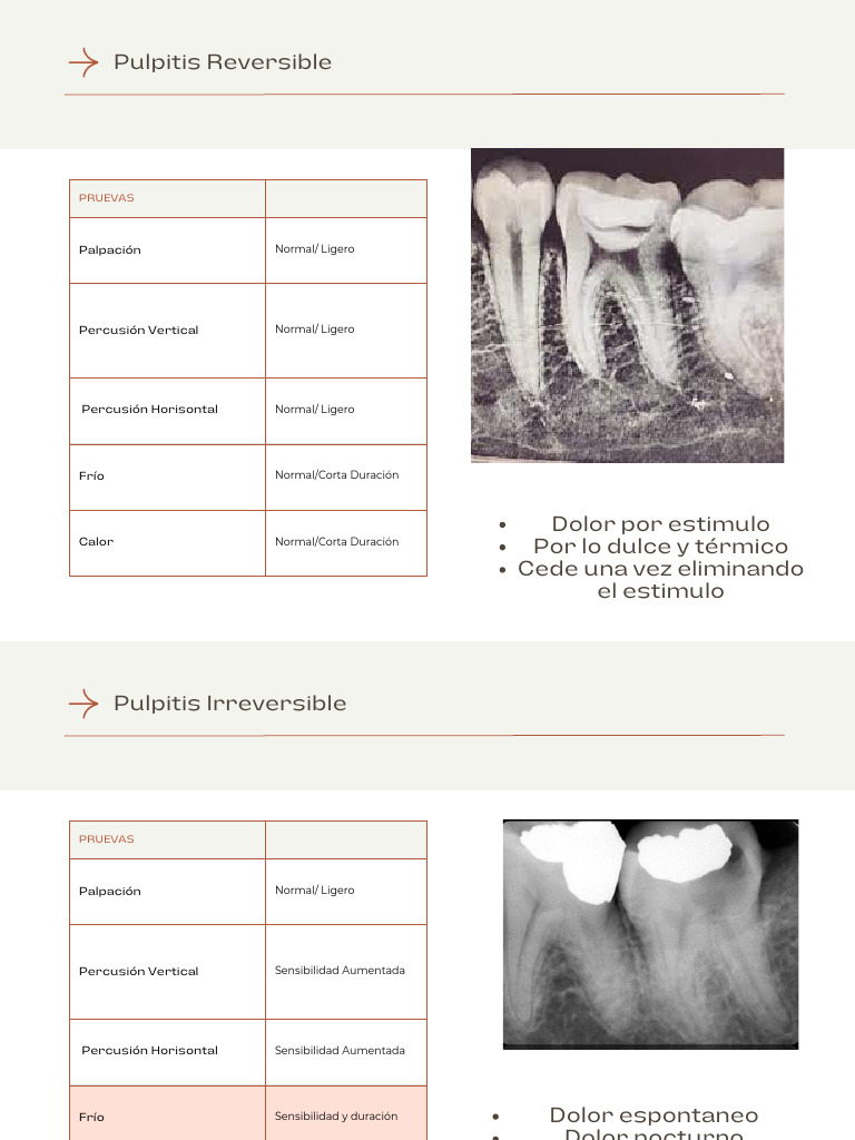 Diagnostico Pulpar y Periapical-Amaru MArtínez Pérez | PDF | Medicina | Inmunología