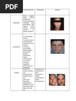 Tipos de Facíes Semiología | PDF | Cara | Anatomía humana