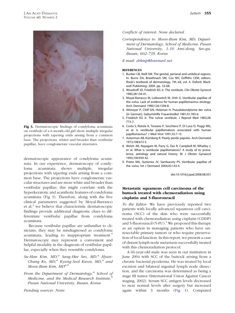 Metastatic Squamous Cell Carcinoma of The Buttock | PDF | Metastasis ...