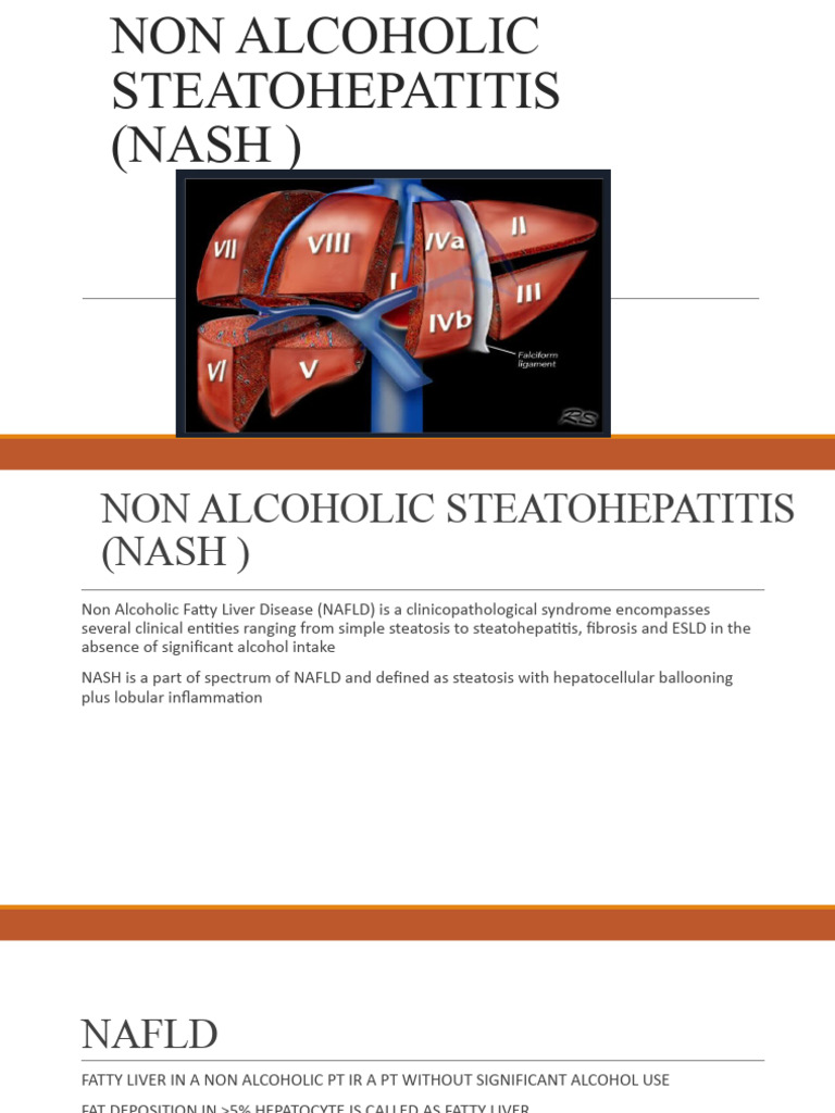NASH: Understanding and Management | PDF | Cirrhosis | Causes Of Death