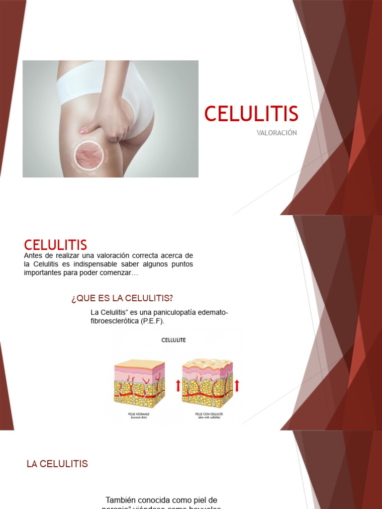 CELULITIS | PDF | Causas de la muerte | Especialidades Medicas