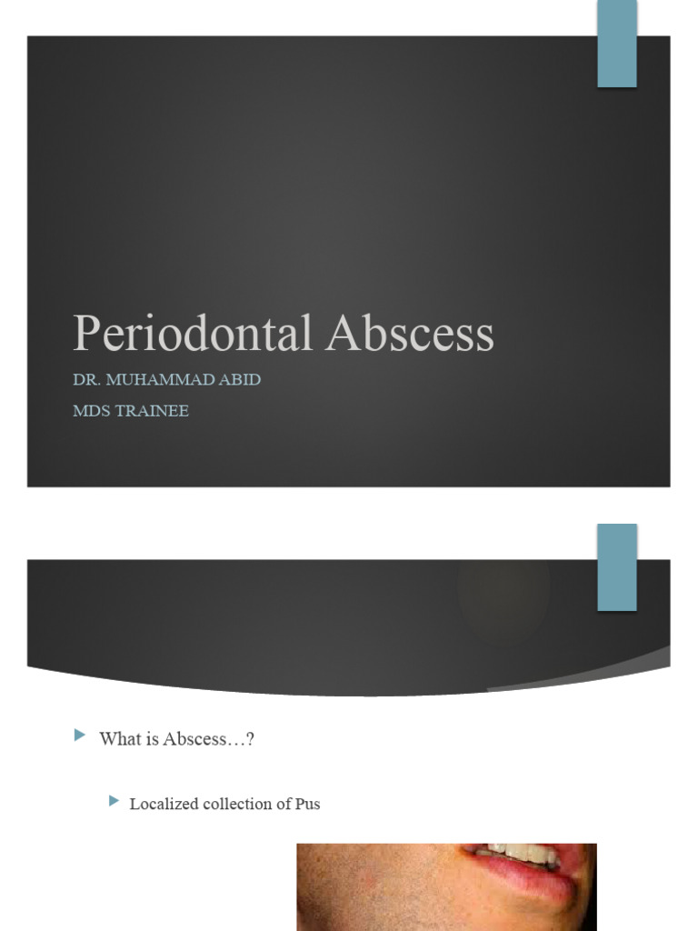 Abcess of Periodontium | Download Free PDF | Periodontology | Diseases ...