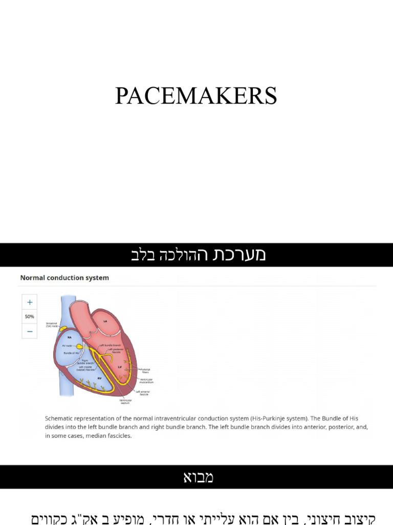 Pacemakers Sharbil | PDF