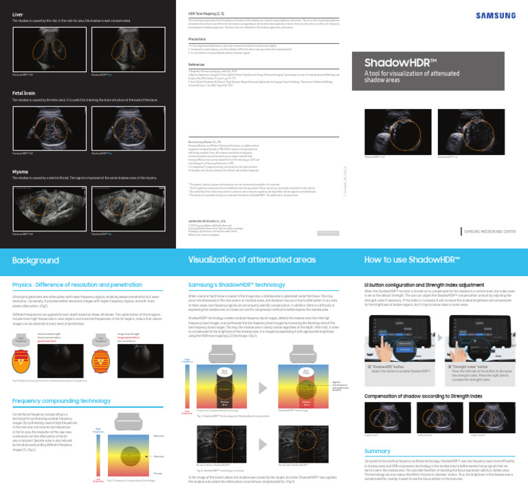 ShadowHDR Tech.leaflet 0126 (2) | PDF | Ultrasound | Medical Imaging