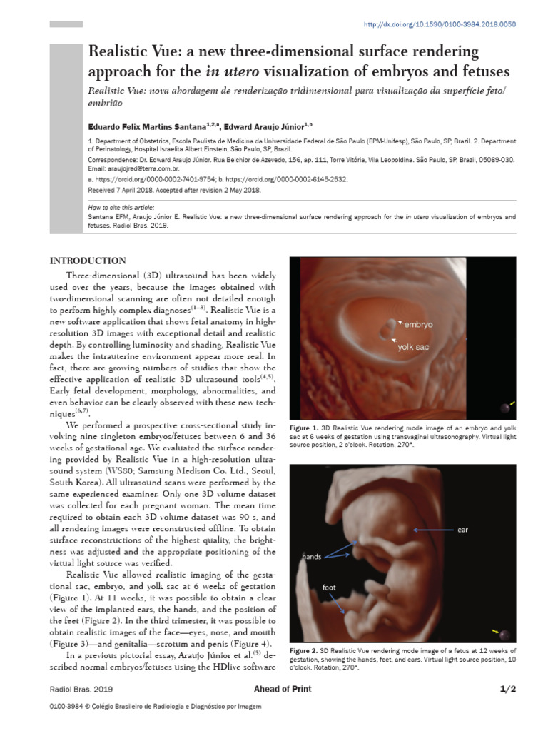 Realistic Vue A New Three-Dimensional Surface Rend | PDF | Fetus ...