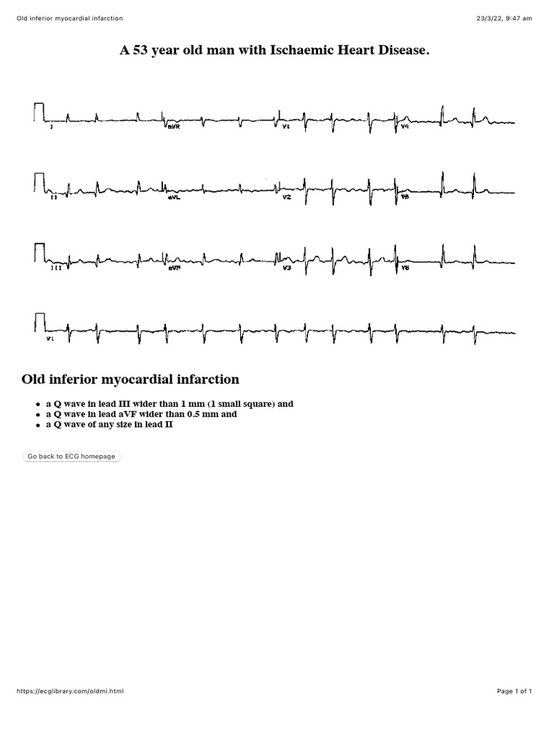 ECG Examples | PDF | Electrocardiography | Cardiac Arrhythmia