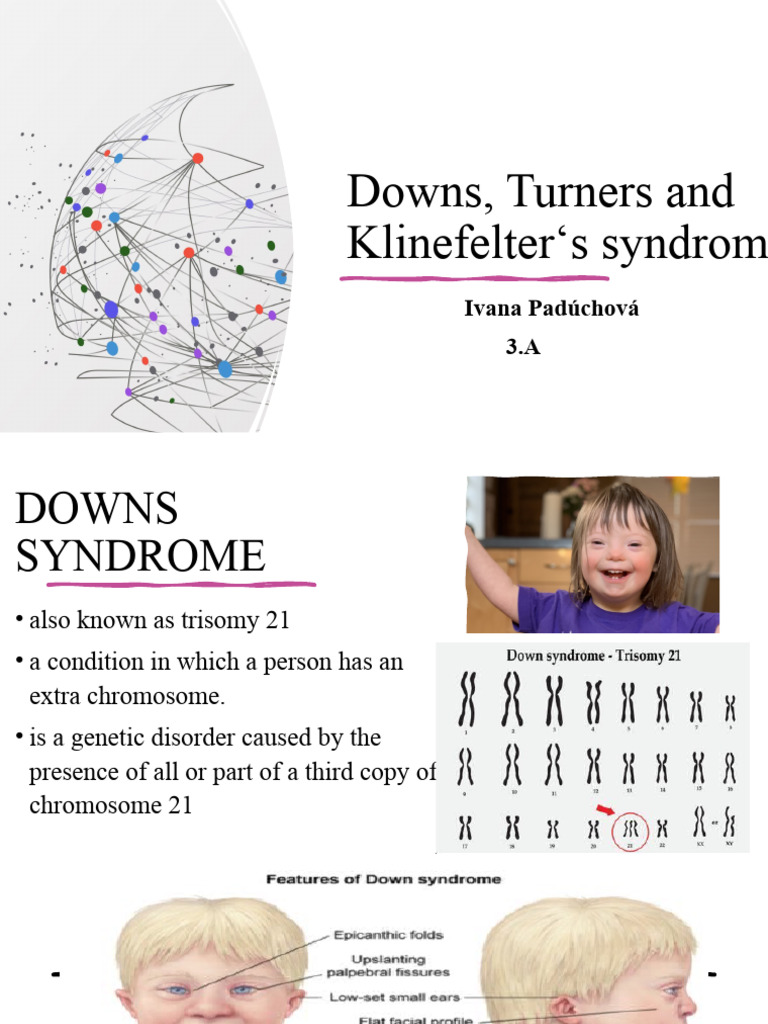 Downs, Turners and Klinefelter S Syndrom | PDF | Down Syndrome ...