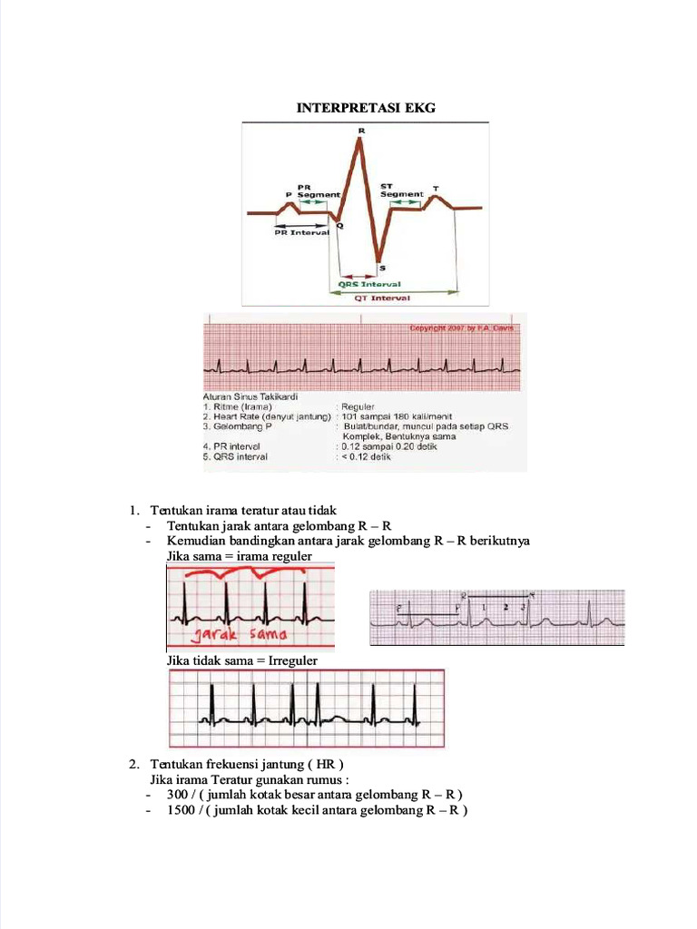 PDF Interpretasi Ekg - Compress | PDF