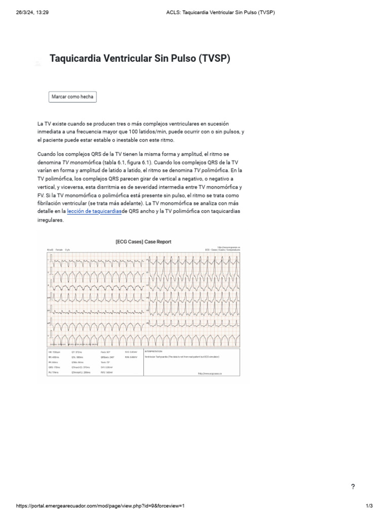 ACLS_ Taquicardia Ventricular Sin Pulso (TVSP) | PDF