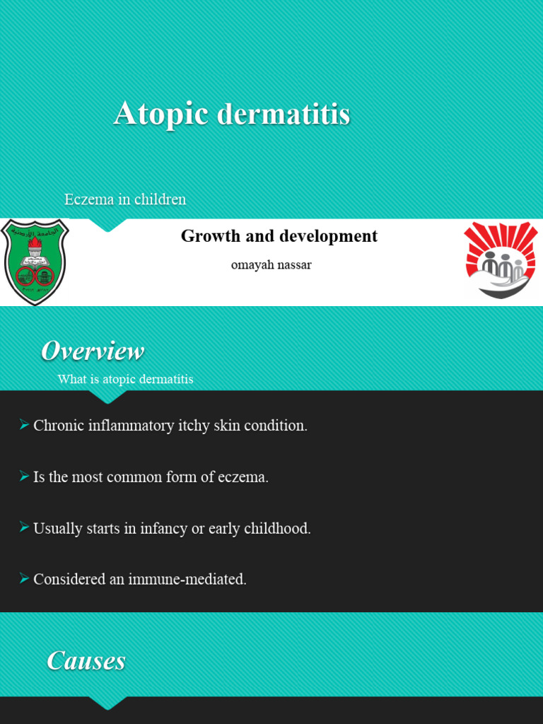 Atopic Dermatitis 1final | PDF | Dermatitis | Causes Of Death
