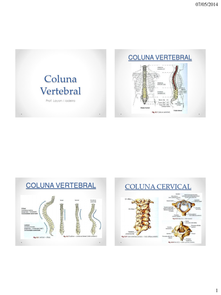 Exames de Raio X da Coluna Vertebral | PDF | Coluna vertebral | Sistema ...