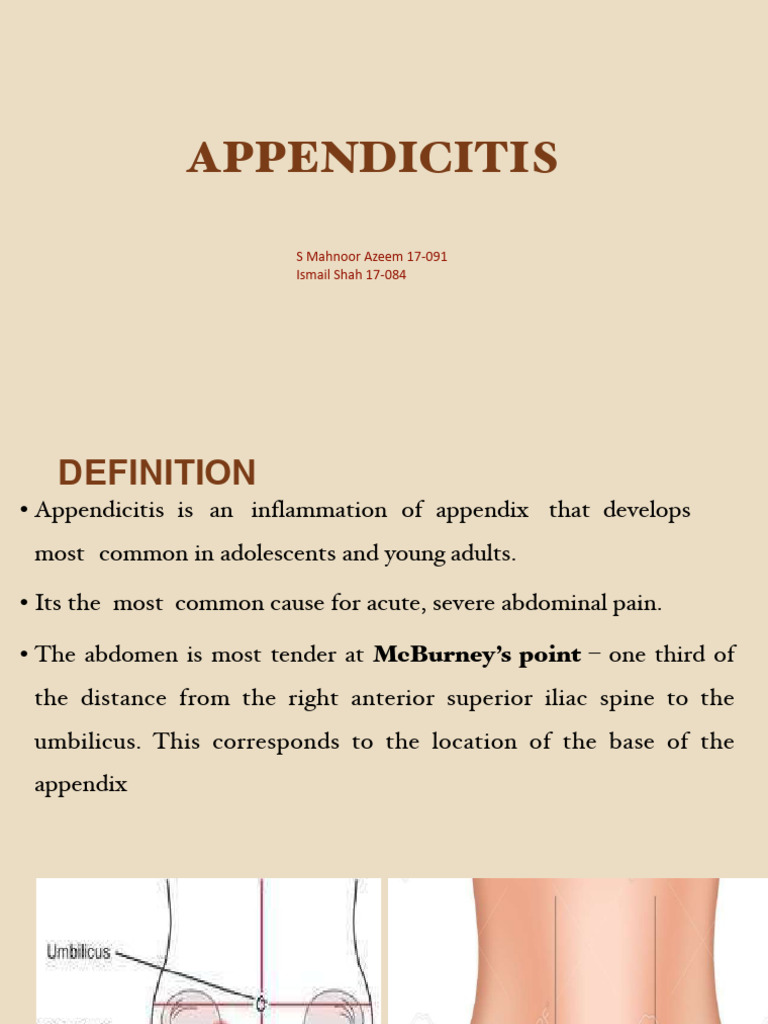 Appendicitis | PDF | Causes Of Death | Clinical Medicine
