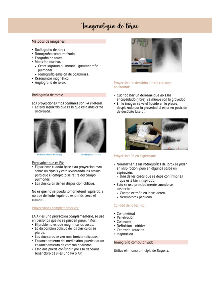 Clase de RX de Tórax | PDF | Pulmón | Corazón