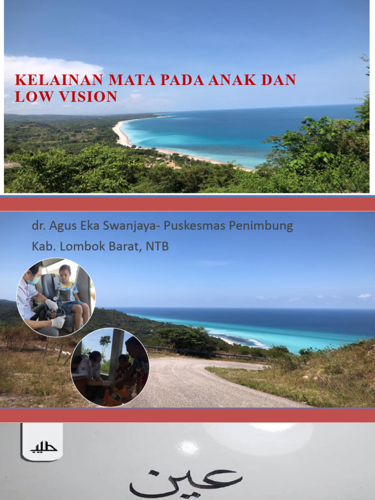 Kelainan Mata - Low Vision | PDF