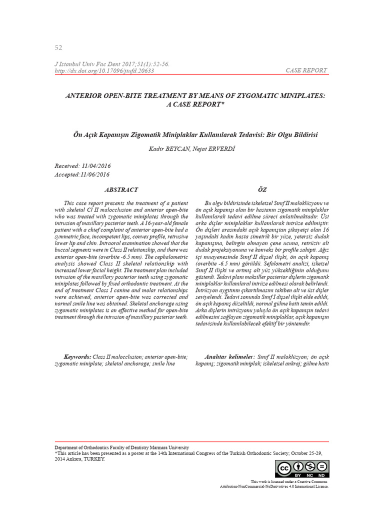 MAA Miniplaca Cigomatica | PDF