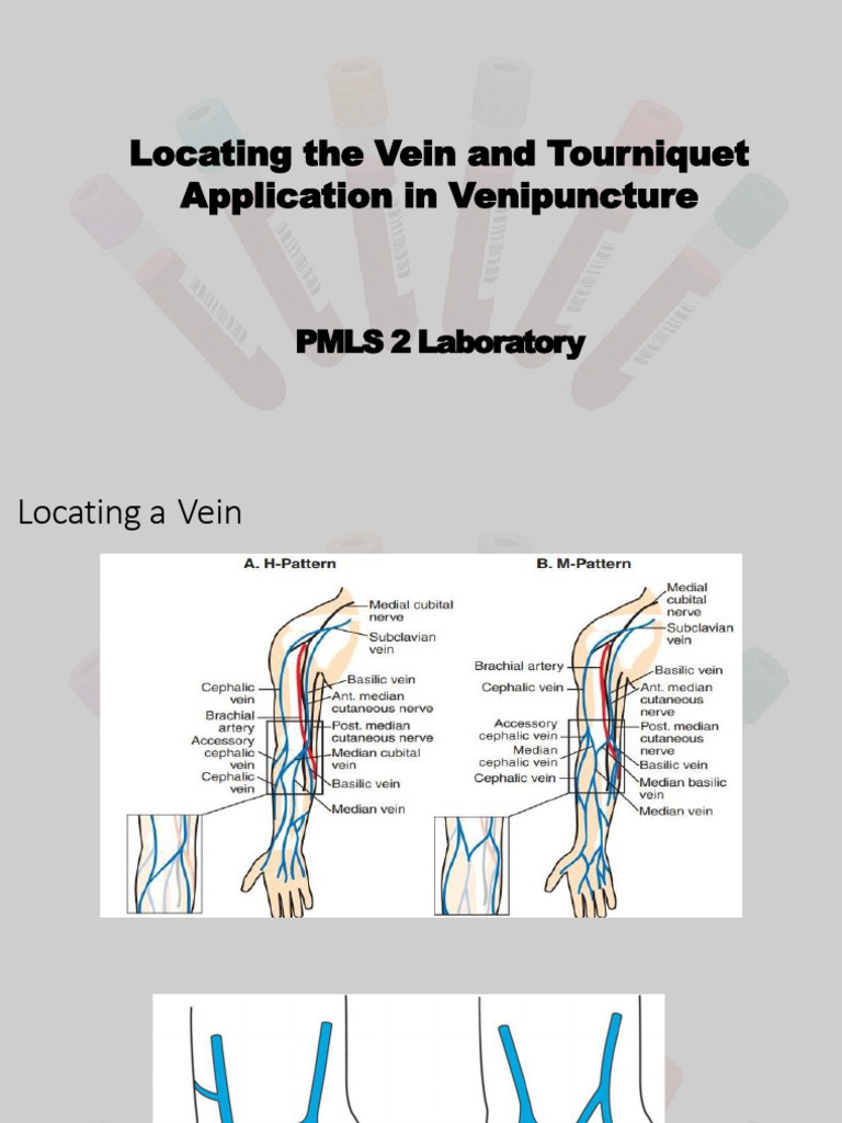 Locating The Vein and Venipuncture Procedures | PDF | Vein | Medical ...