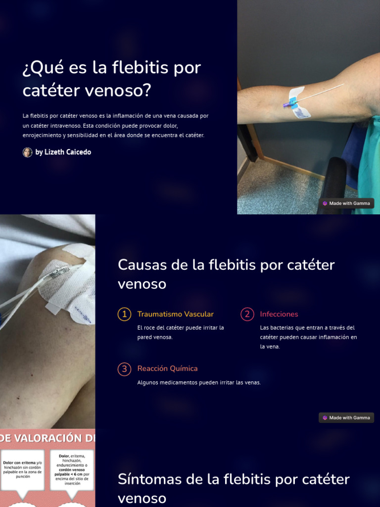 Que Es La Flebitis Por Cateter Venoso | PDF | Terapia intravenosa ...