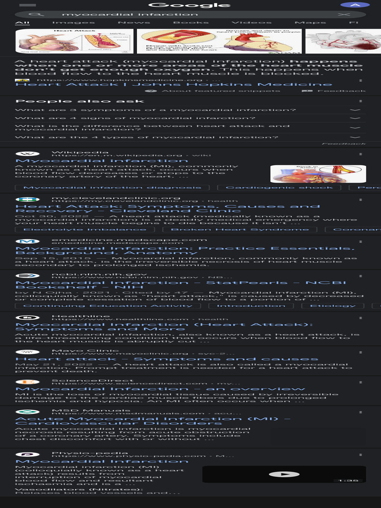 Myocardial Infarction - Google Search | PDF | Myocardial Infarction ...