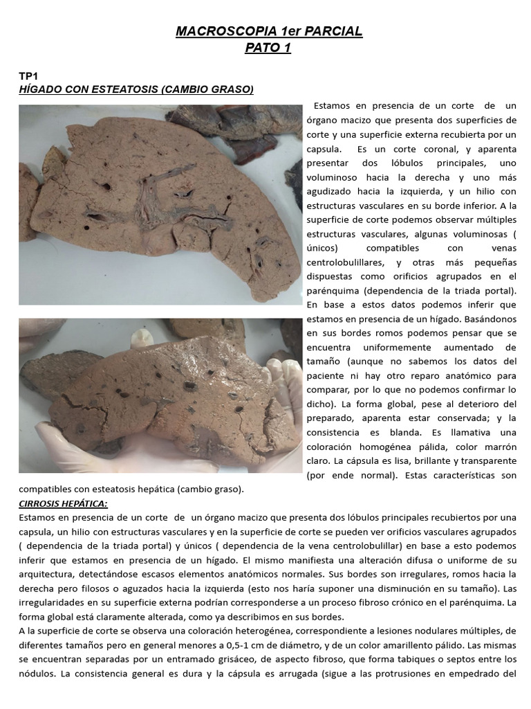 Macroscopia 1er Parcial | PDF | Hígado | Cirrosis