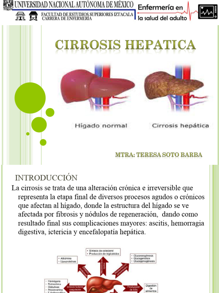 Cirrosis Hepática | PDF | Cirrosis | Hígado