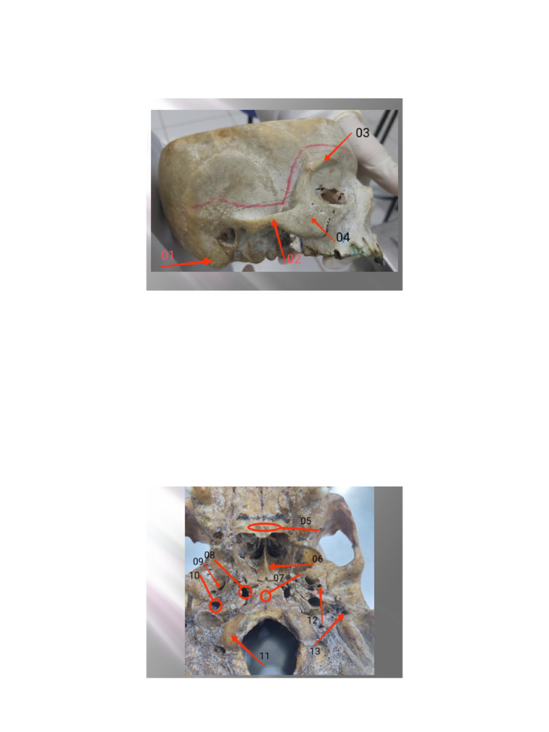 Anatomia dos Forames e Estruturas Cranianas | PDF