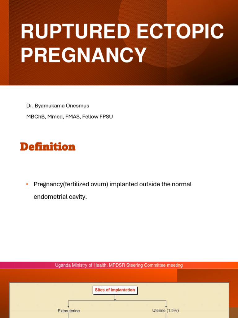 Ruptured Ectopic Presentation | PDF | Medical Specialties | Human Reproduction