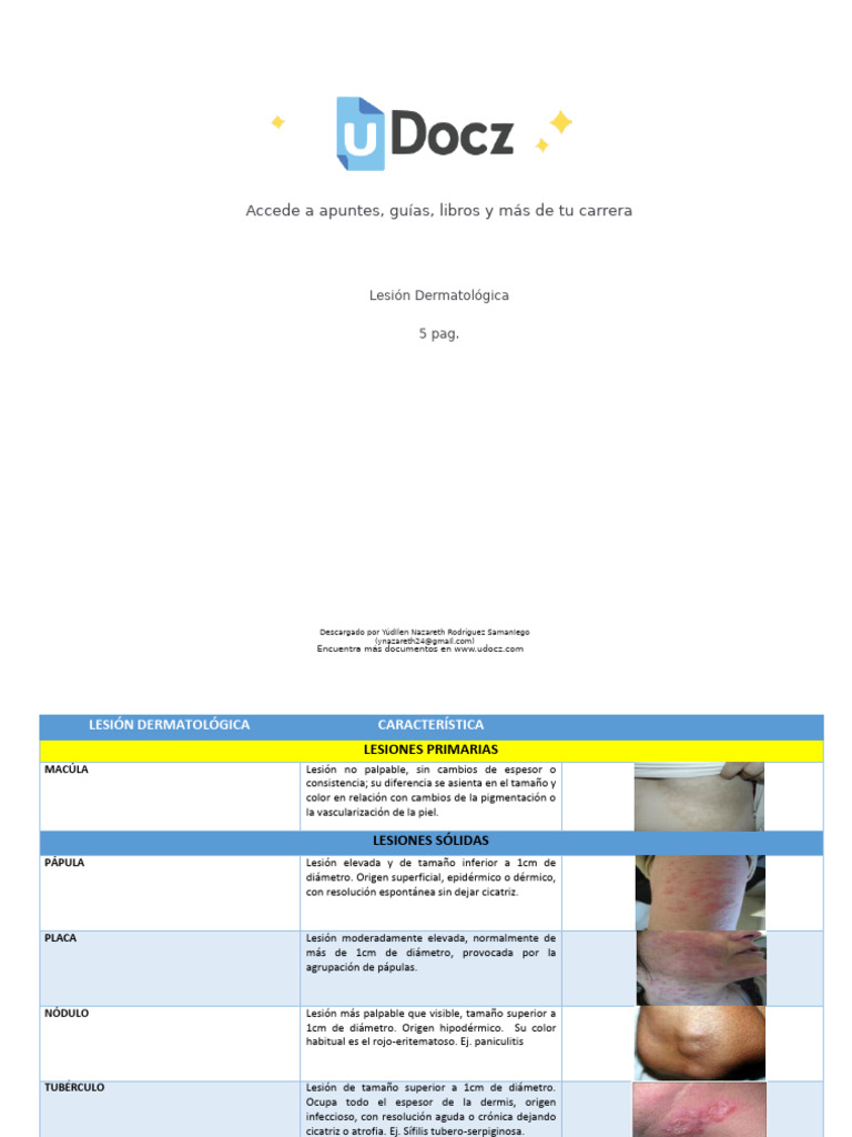 Lesio N Dermatolo Gi 240625 Downloadable 1471645 | PDF | Piel | Epidermis
