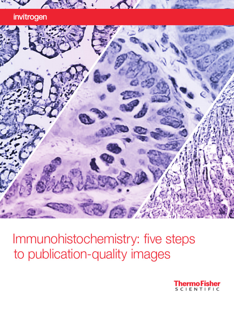 Immunohistochemistry Steps Publication Images Brochure | PDF ...