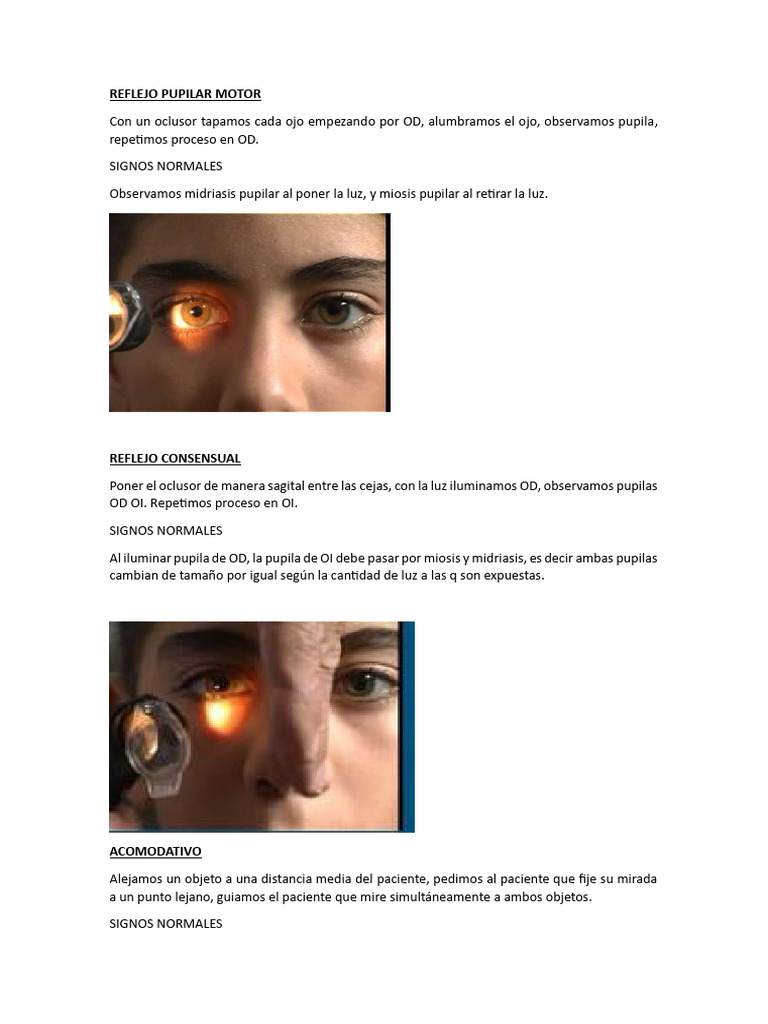 Evaluación del Reflejo Pupilar Motor | PDF | Ojo | Óptica