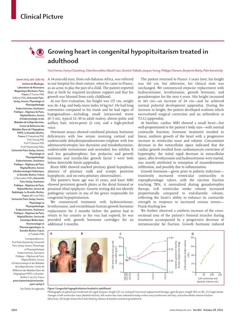 Growing Heart in Congenital Hy | PDF | Pituitary Gland | Growth Hormone