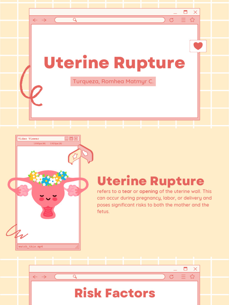 Uterine Rupture Uwu | PDF