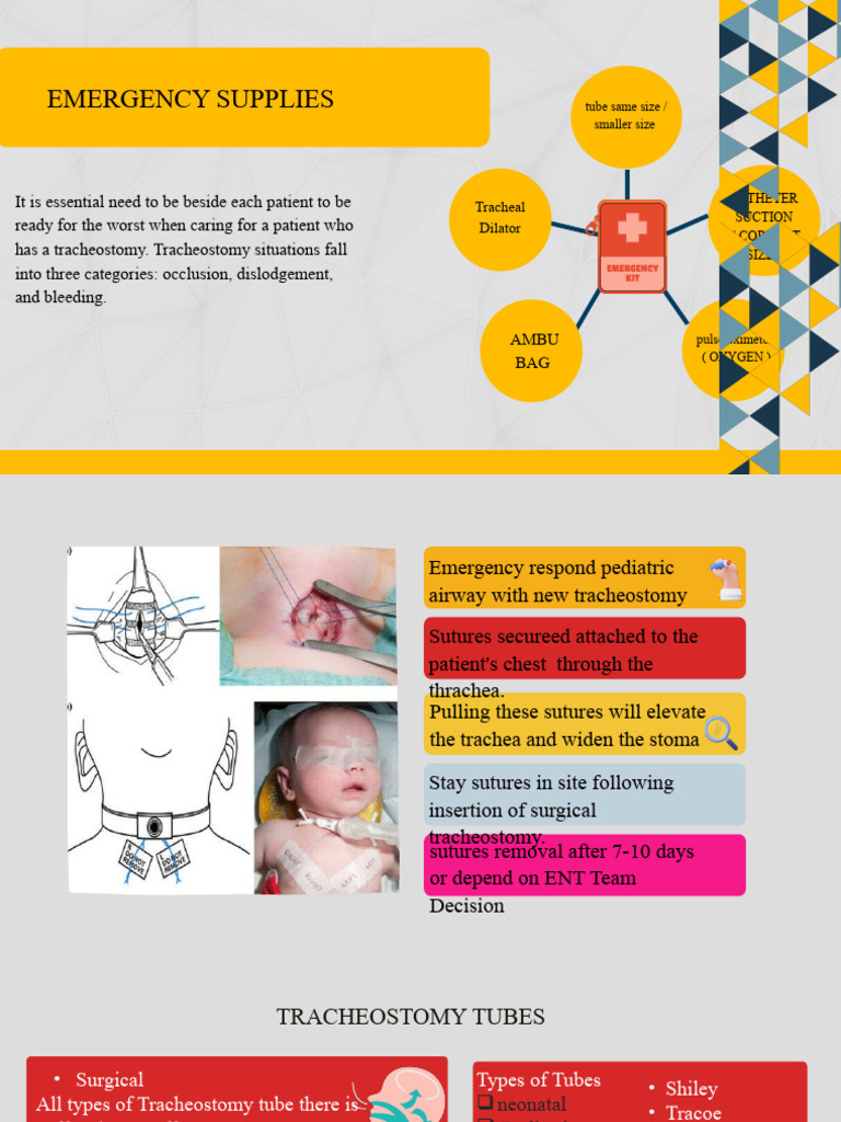 Tracheostomy Presentation | PDF | Clinical Medicine | Medical Specialties