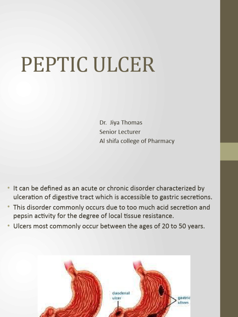 Peptic Ulcer | PDF