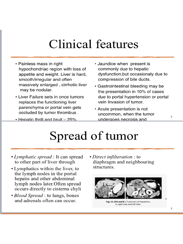 Clinical Feature | PDF
