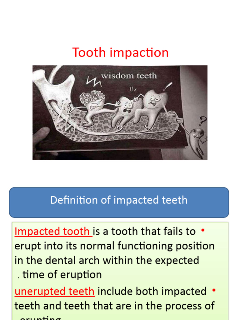 DR - Fidaa Impaction-1 | PDF | Human Tooth | Dental Anatomy