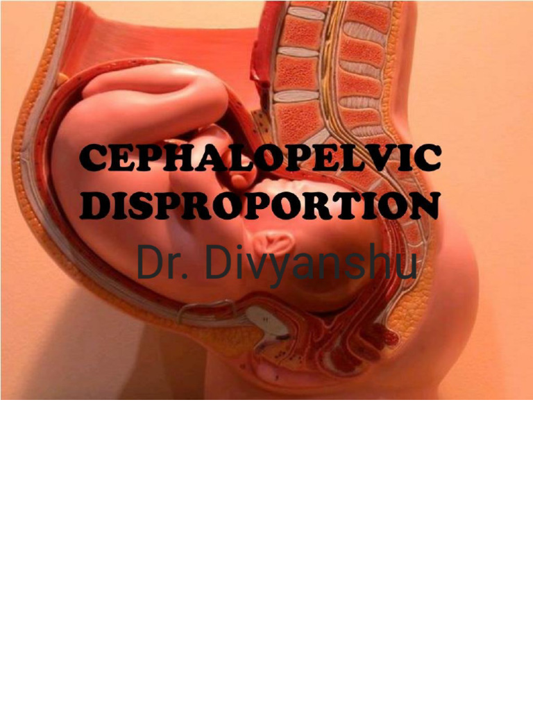 Cephalopelvic Disproportion | PDF