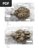 Subcutaneous Butterfly | PDF | Intravenous Therapy | Saline (Medicine)