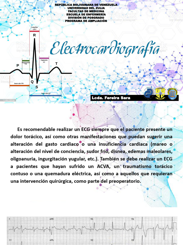 Electro 2022 | PDF | Electrocardiografia | Sistema cardiovascular