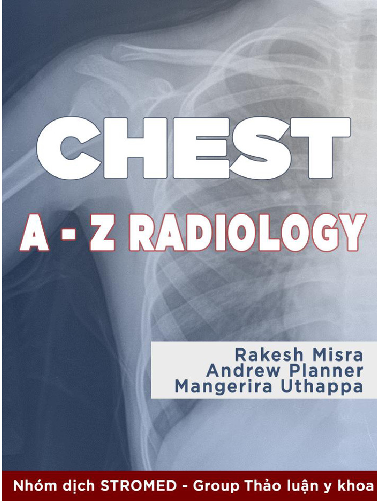 A Z of Chest Radiology | PDF