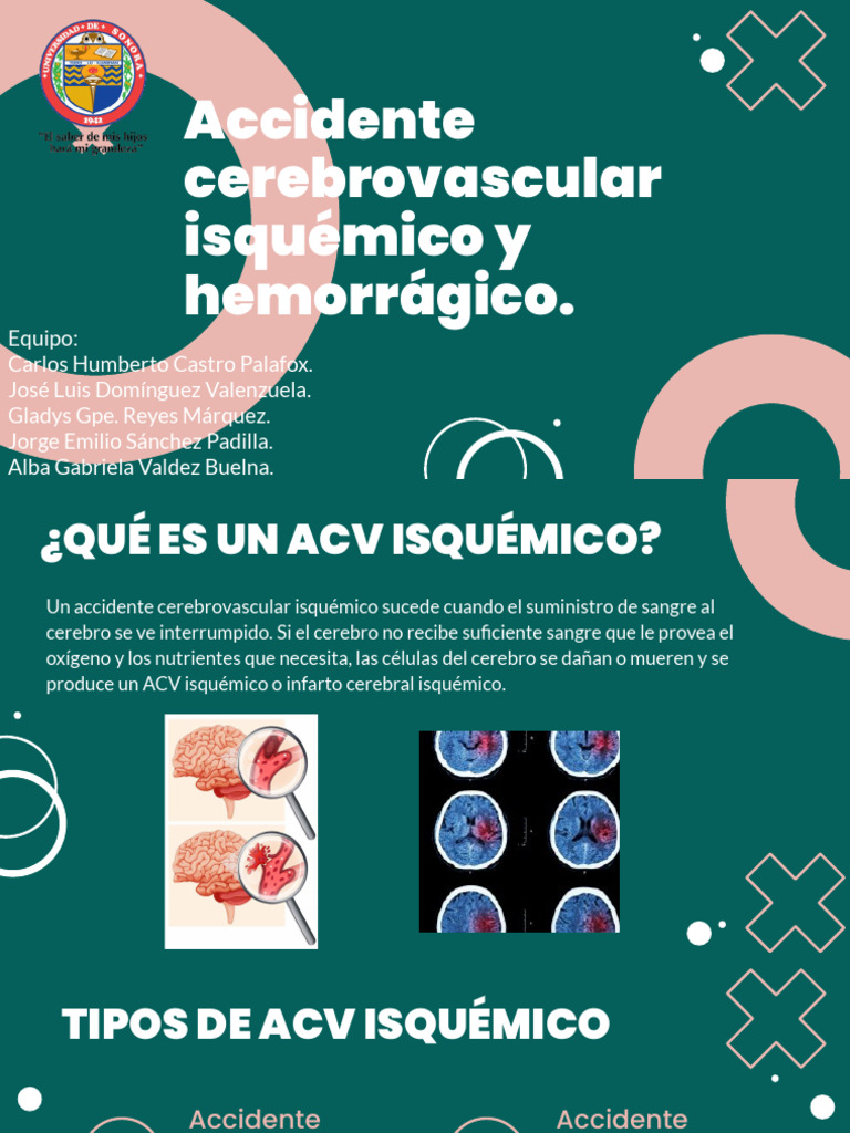 Acv Isquemico y Hemorragico | PDF | Carrera | Isquemia