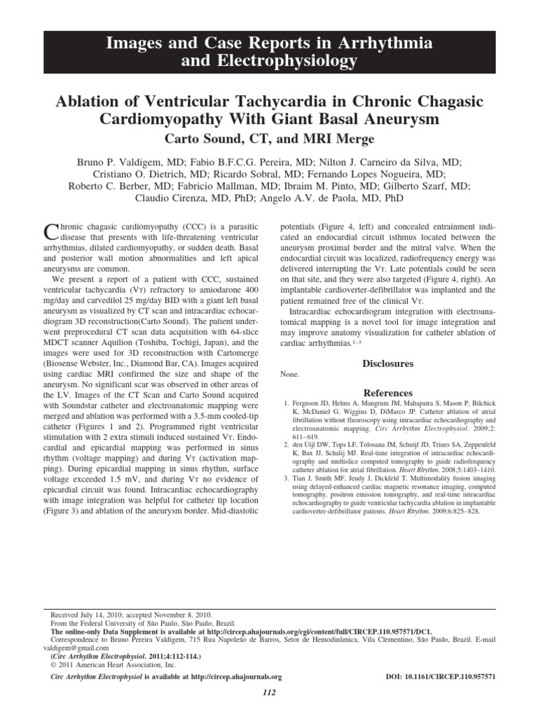 Ablation of Ventricular Tachycardia in Chronic Chagasic Cardiomyopathy ...