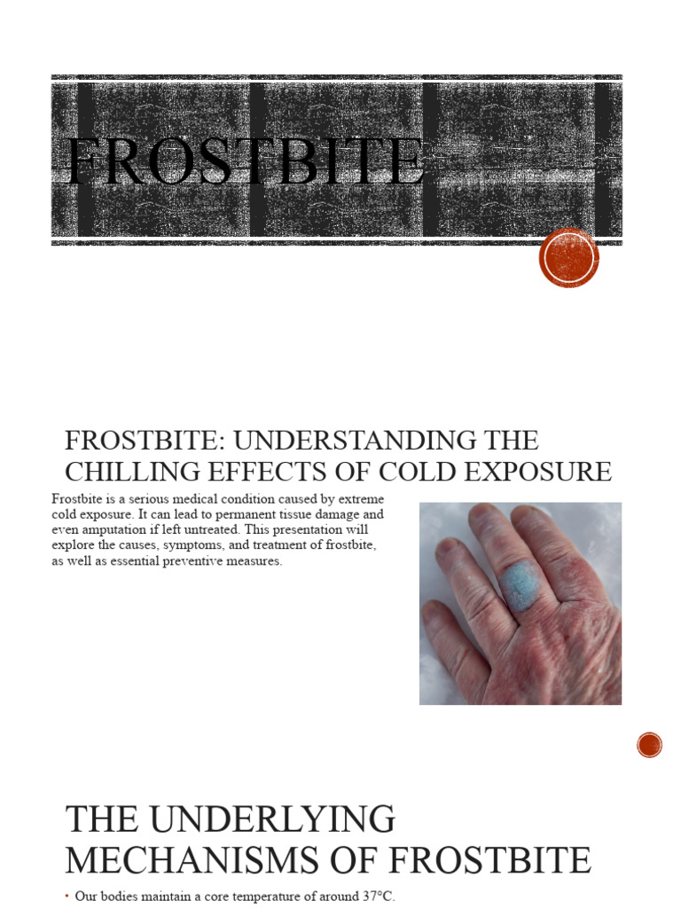 Frostbite | PDF | Hypothermia | Diseases And Disorders