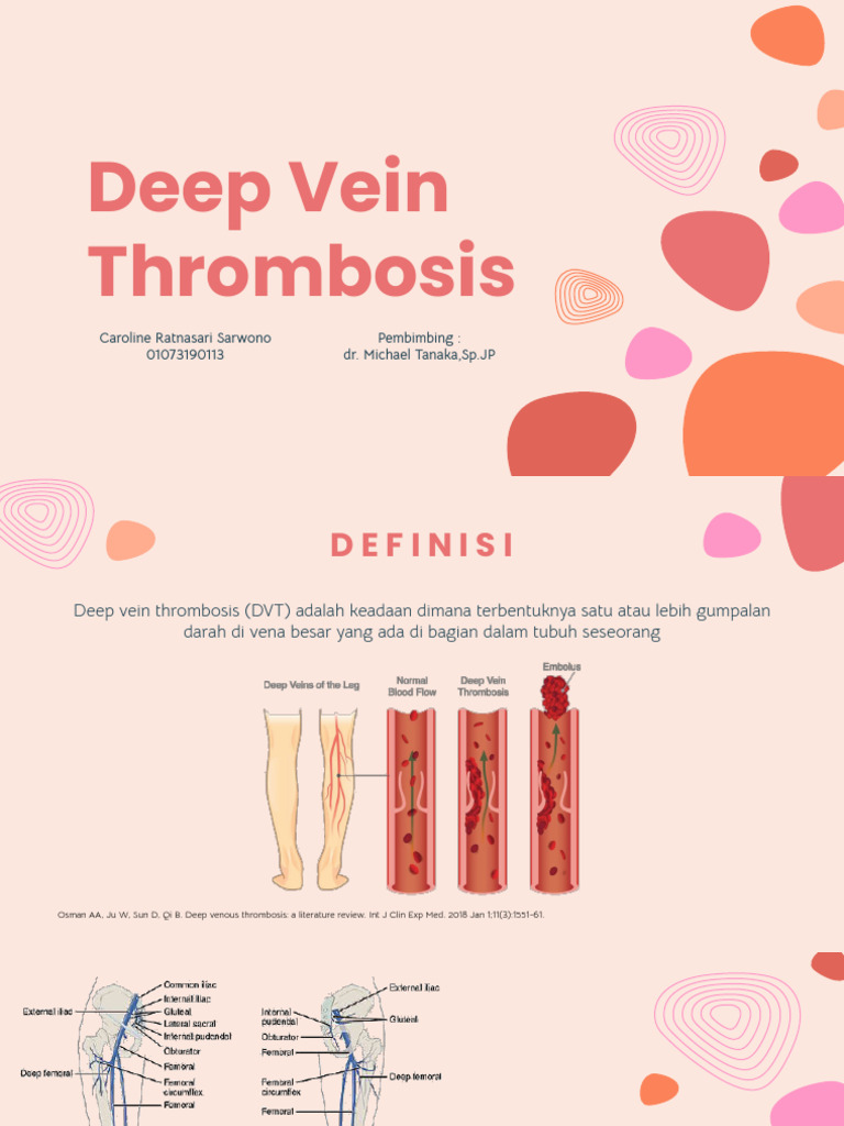Understanding Deep Vein Thrombosis (DVT) | PDF | Thrombosis | Vein