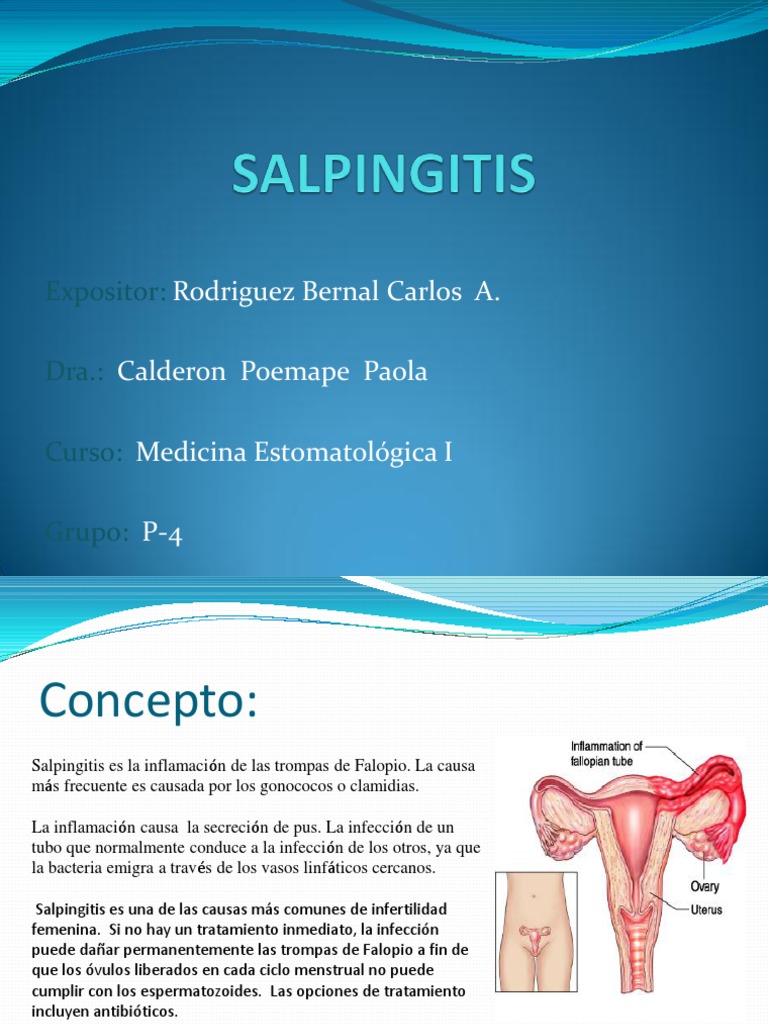 Tratamiento y síntomas de salpingitis | PDF | Anatomia sexual | Salud ...