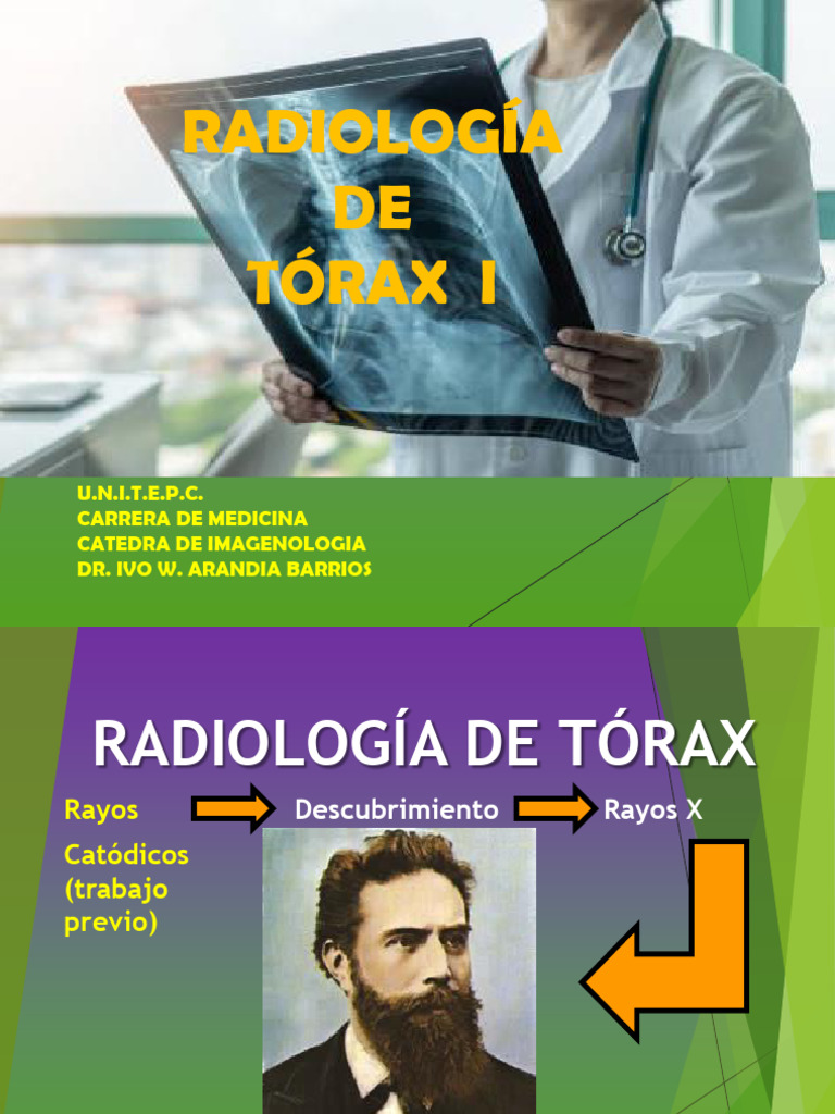 RX Torax I | PDF | Aorta | Pulmón