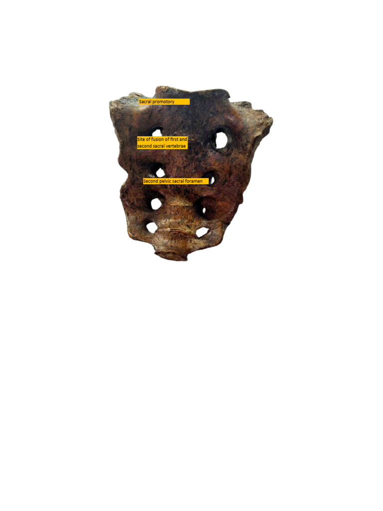 Sacral Vertebrae Anatomy Overview | PDF