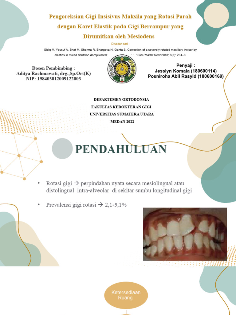 Koreksi Rotasi Gigi Insisivus | PDF