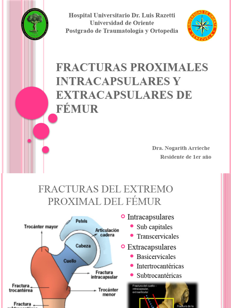 Fracturas Proximales de Femur | PDF