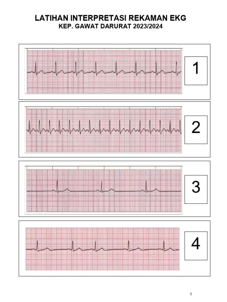 Latihan Interpretasi EKG 2023/2024 | PDF